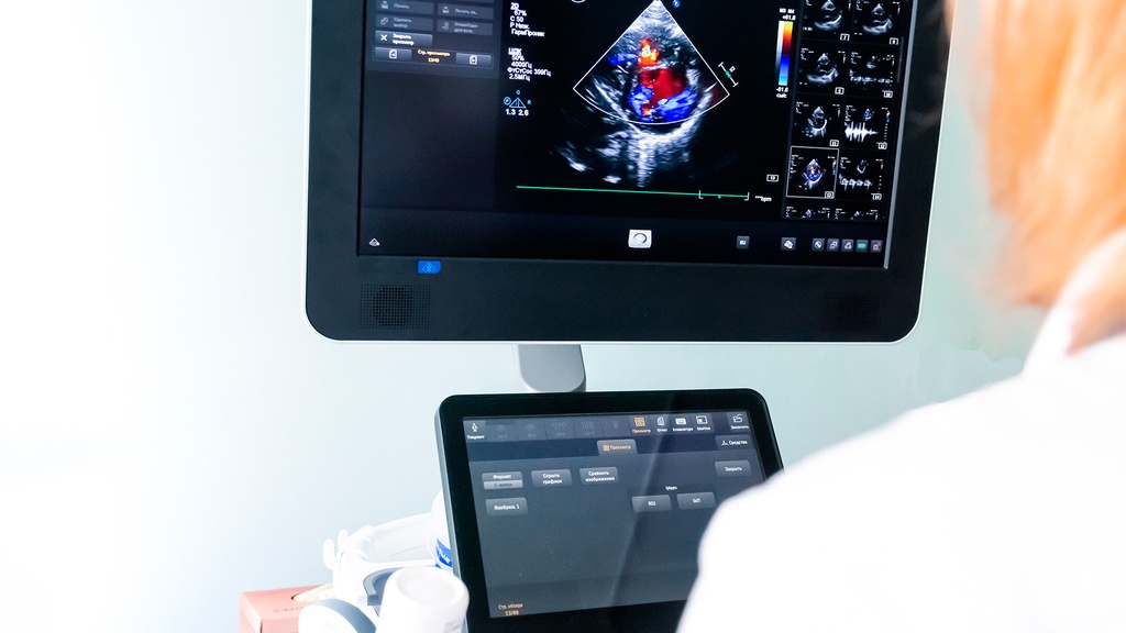 Ultrasonido Cromosomico | Lapi Laboratorio Médico